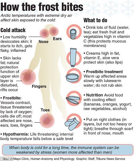 Exclusive Blog: What to do when the "Frostbite" series is aptly named ...